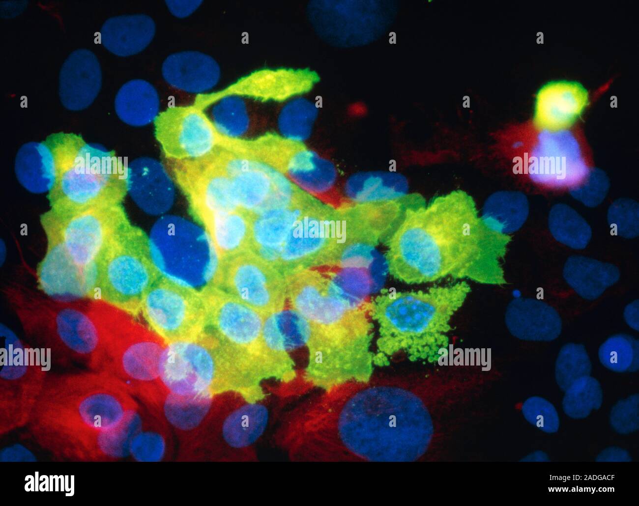 Apoptosis. Immunofluorescent Light Micrograph of a culture of normal ...