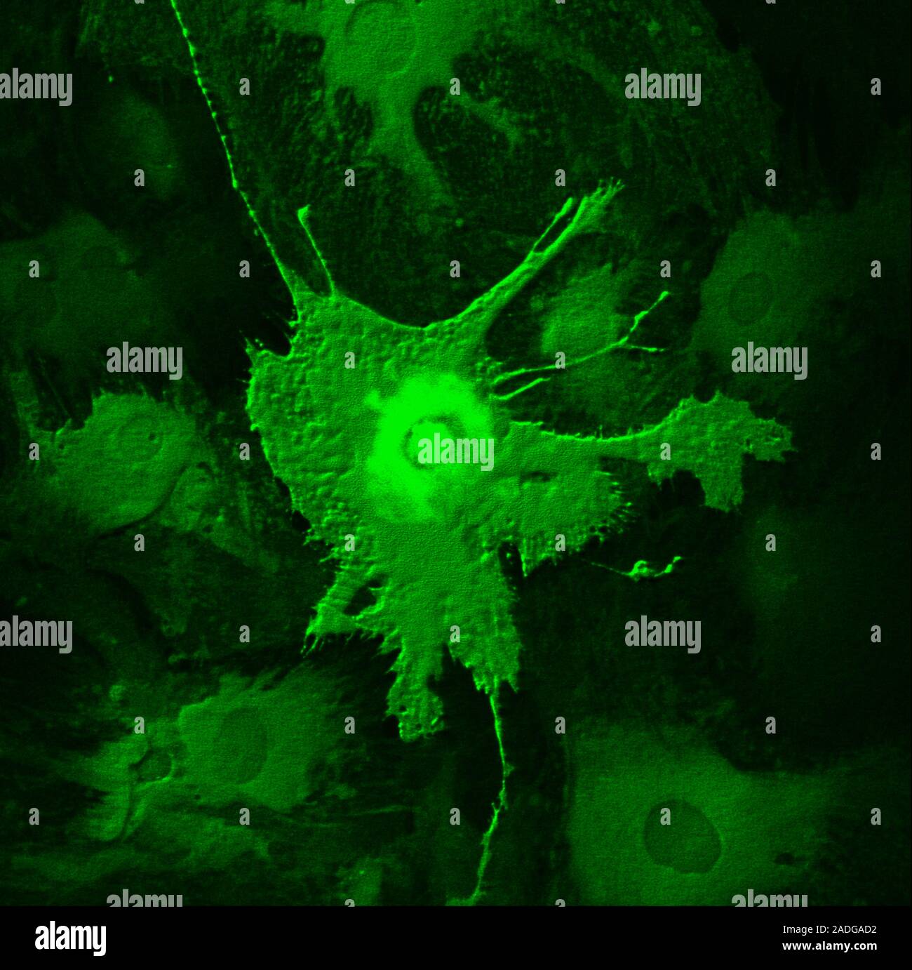 Human cell, confocal light micrograph. This unidentified cell has a ...