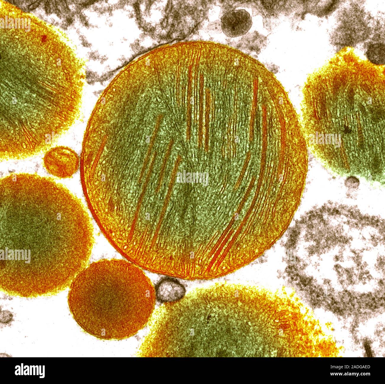 Mitochondria. Coloured transmission electron micrograph of mitochondria ...