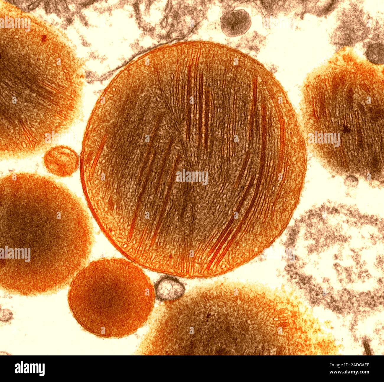 Mitochondria. Coloured transmission electron micrograph of mitochondria ...