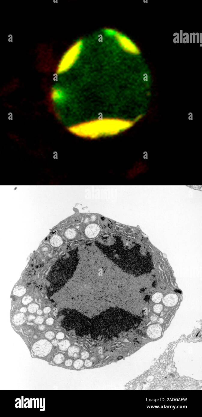 Programmed cell death. Comparison of a fluorescent light micrograph ...