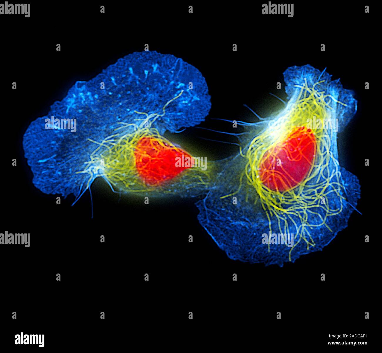 Fish skin cells. Epifluorescence light micrograph of two keratocytes ...