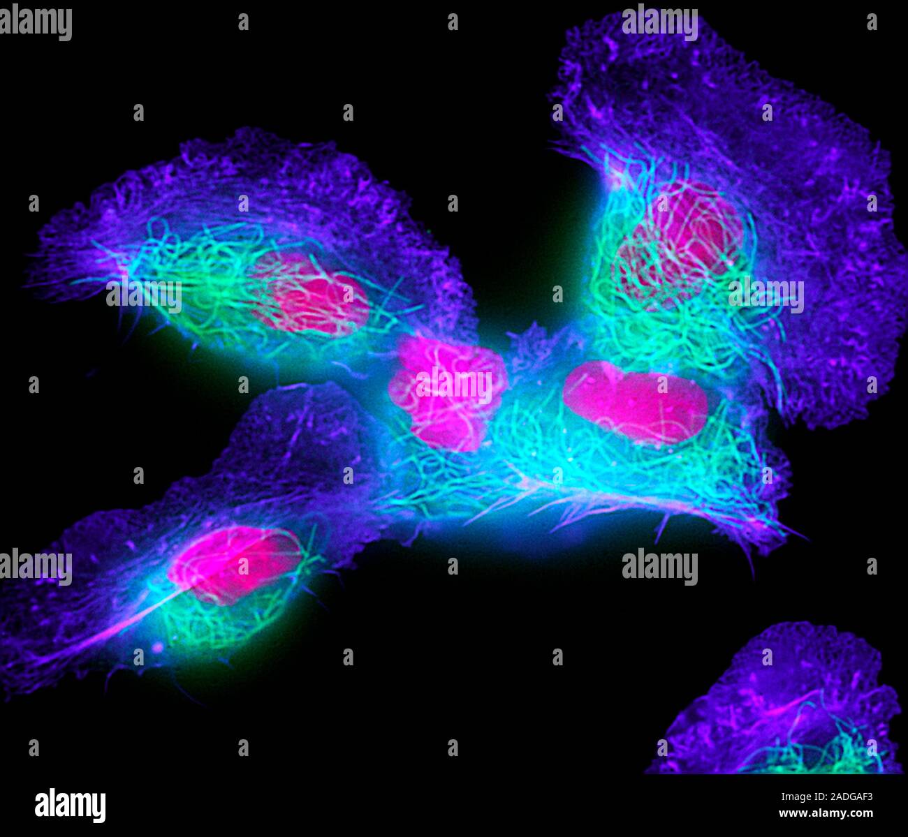 Fish skin cells. Epifluorescence light micrograph of keratocytes (fish ...