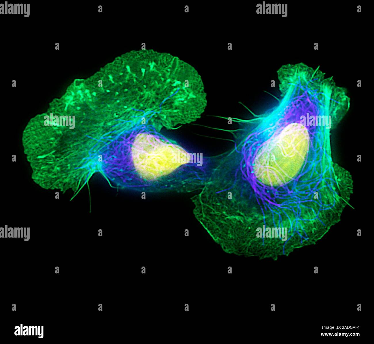 Fish skin cells. Epifluorescence light micrograph of two keratocytes ...