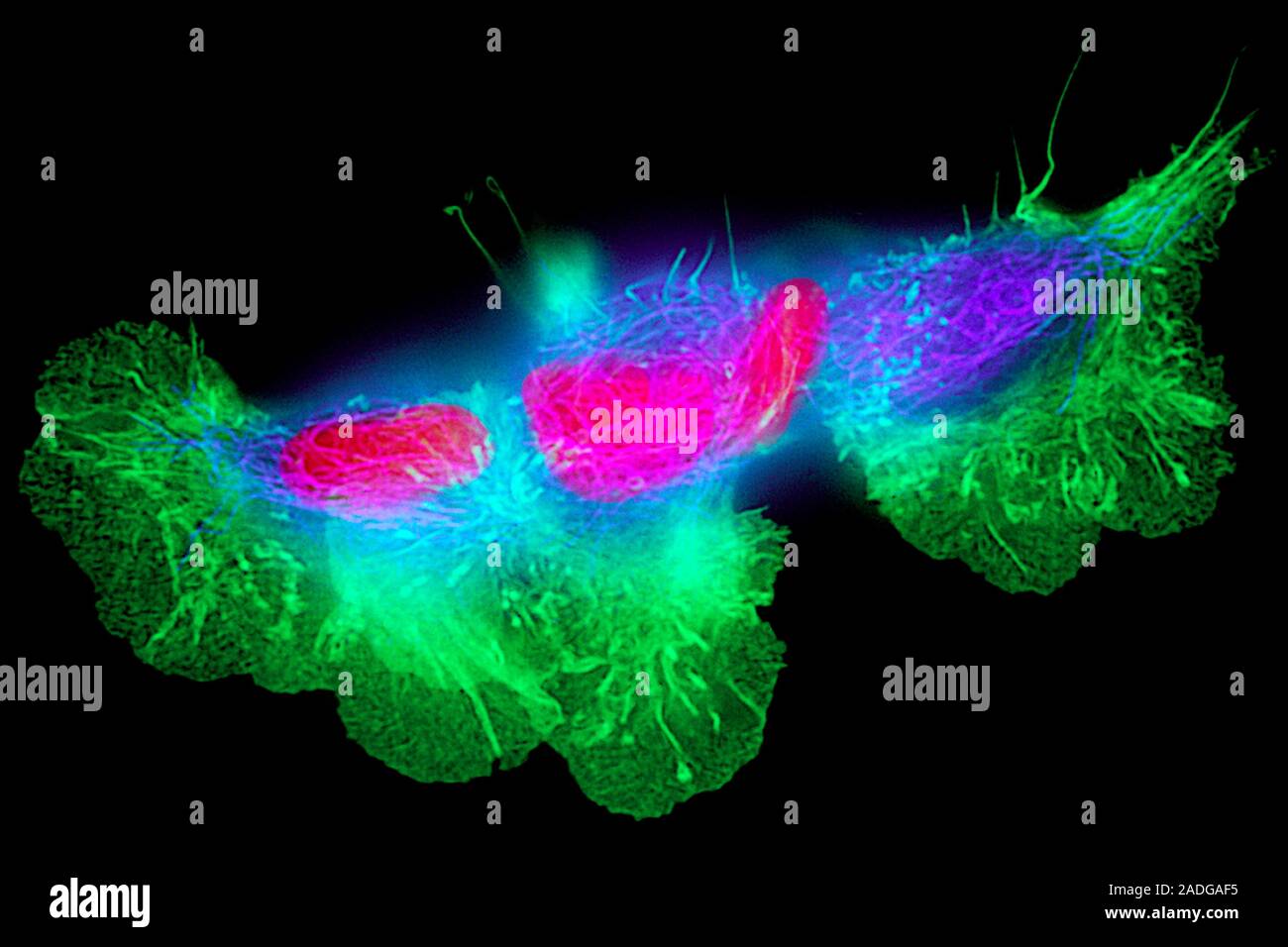 Fish skin cells. Epifluorescence light micrograph of three keratocytes ...