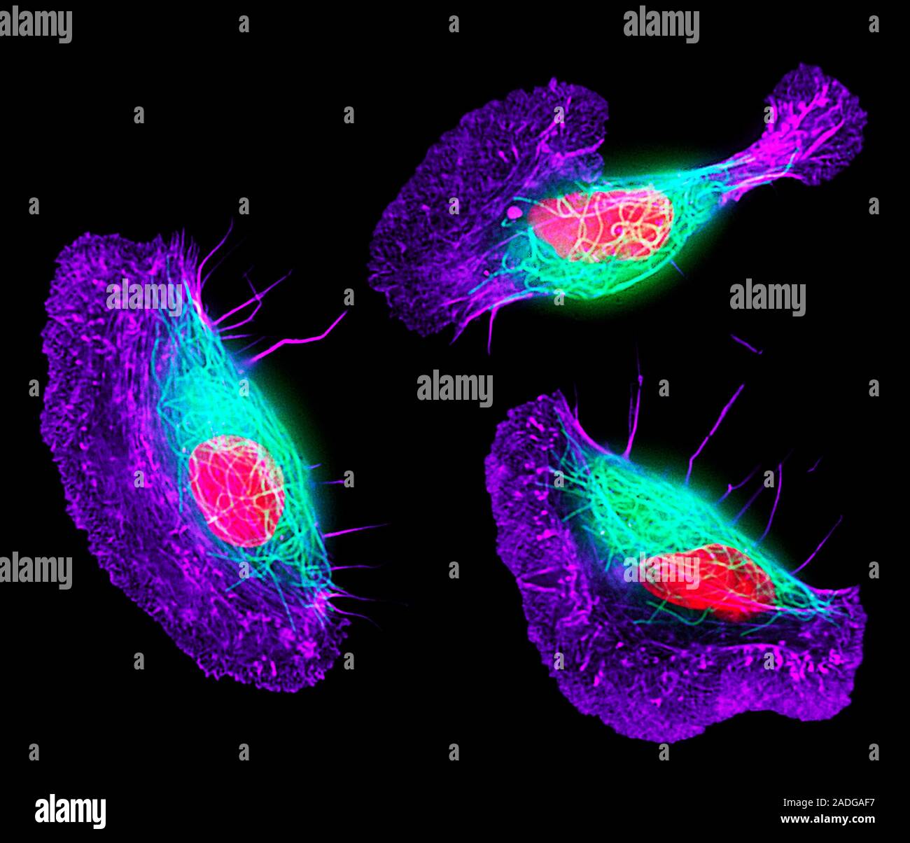 Fish skin cells. Epifluorescence light micrograph of three keratocytes ...