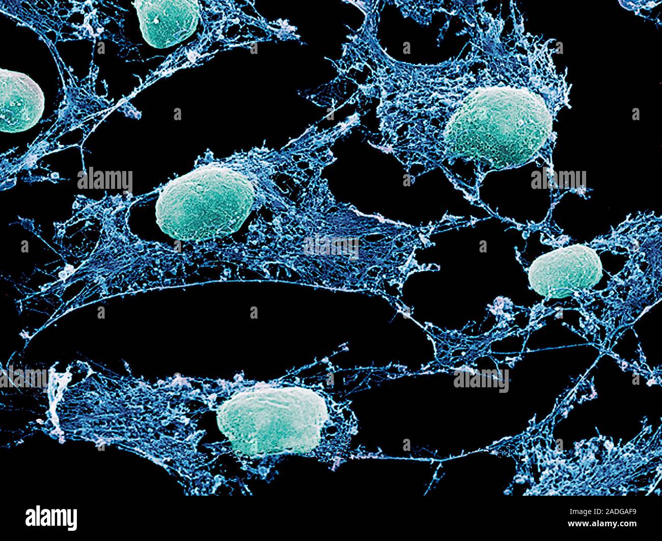 Cell cytoskeleton. Coloured scanning electron micrograph (SEM) of the ...