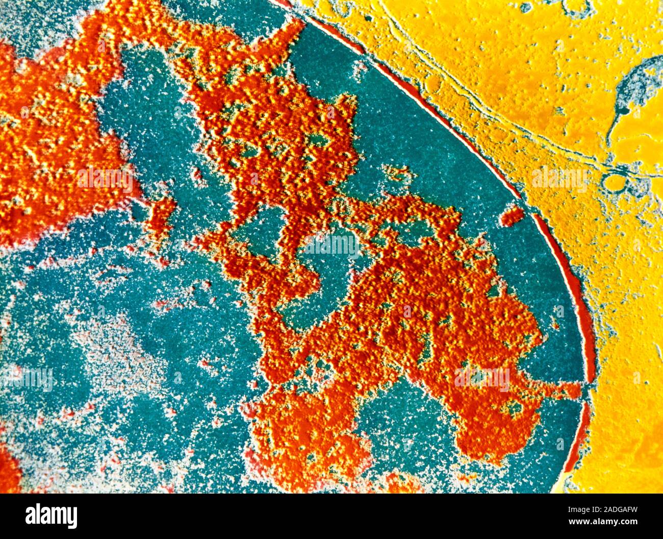 False-colour transmission electron micrograph (TEM) of a typical ...