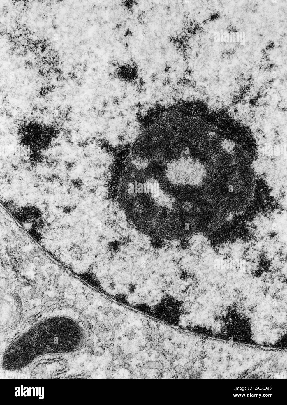 Transmission electron micrograph of a section through a nucleolus ...