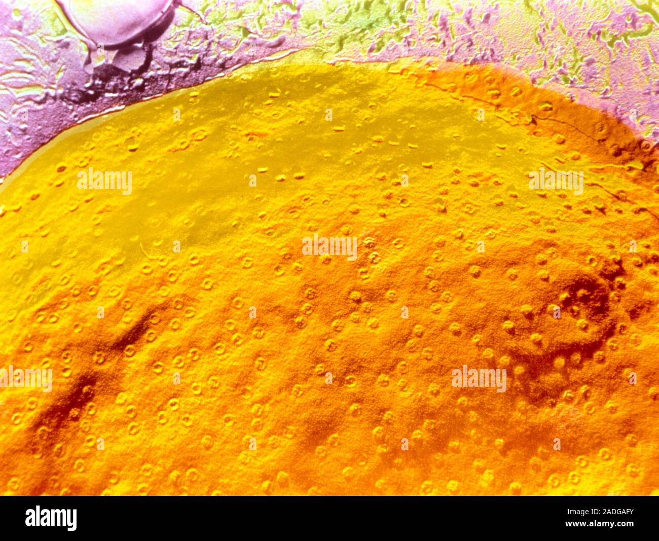 False-colour transmission electron micrograph of the external surface ...