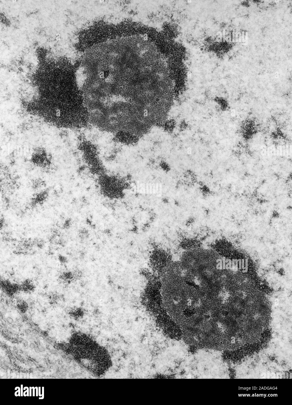 Nucleoli. Transmission electron micrograph of two nucleoli (dark areas ...