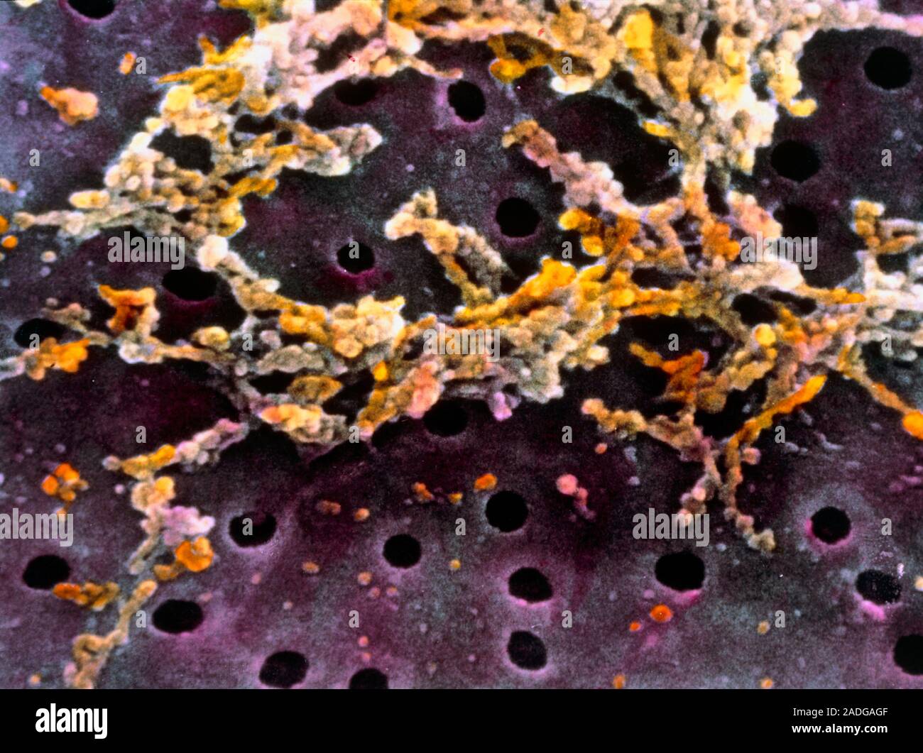 Nuclear pores and chromatin. Coloured high resolution scanning electron ...