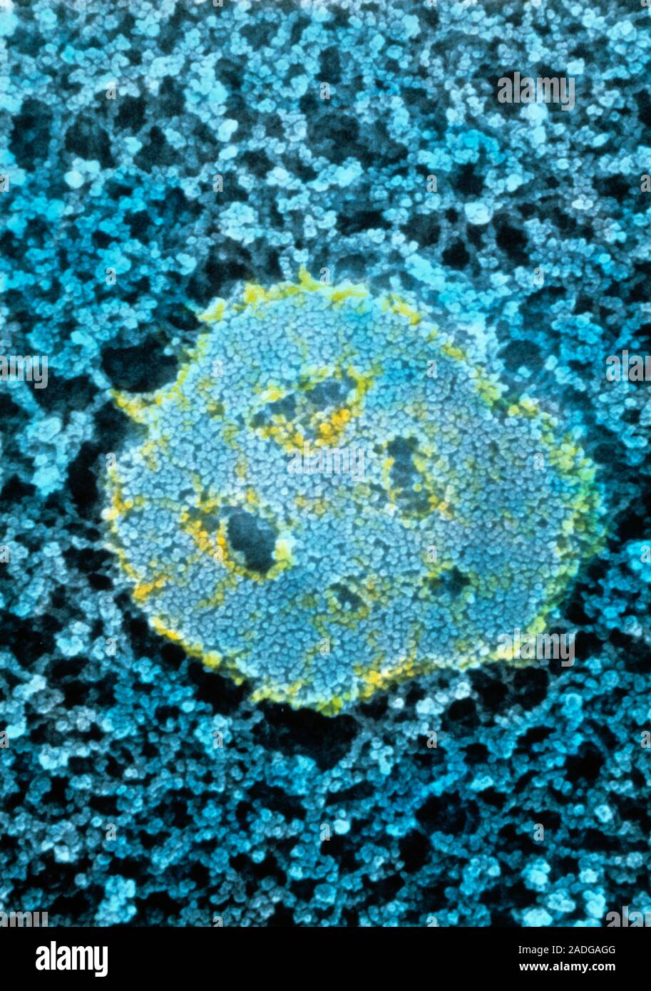 Nucleolus and chromatin fibres. Coloured high resolution scanning ...