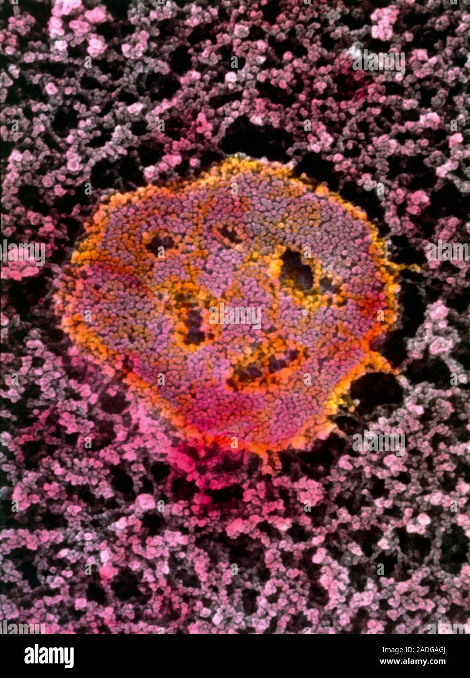 Nucleolus and chromatin fibres. Coloured high resolution scanning ...