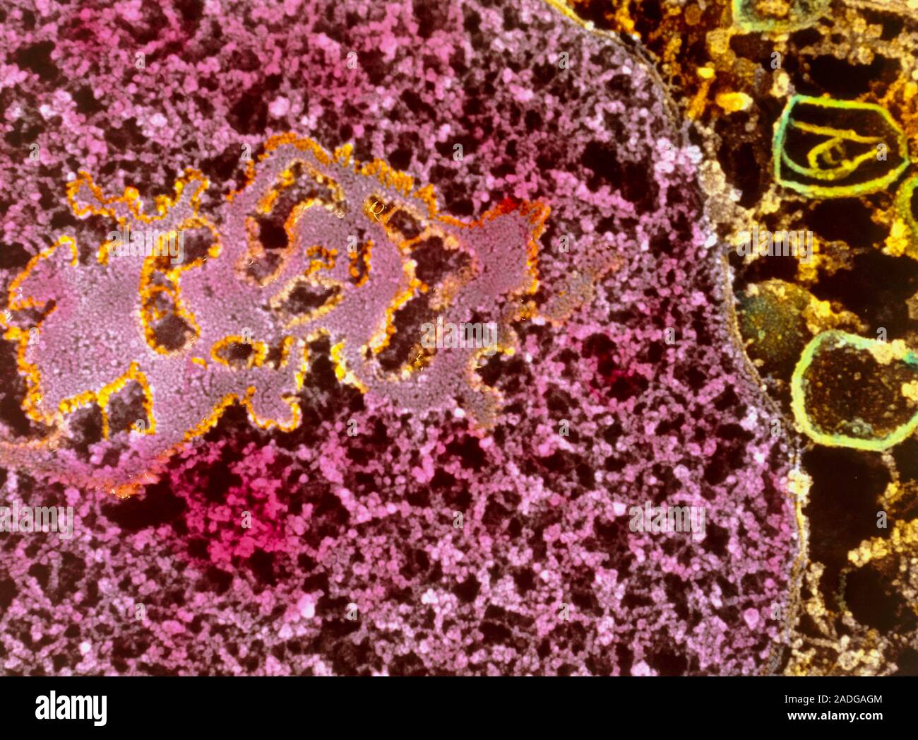 Nucleolus And Chromatin Fibres Coloured High Resolution Scanning