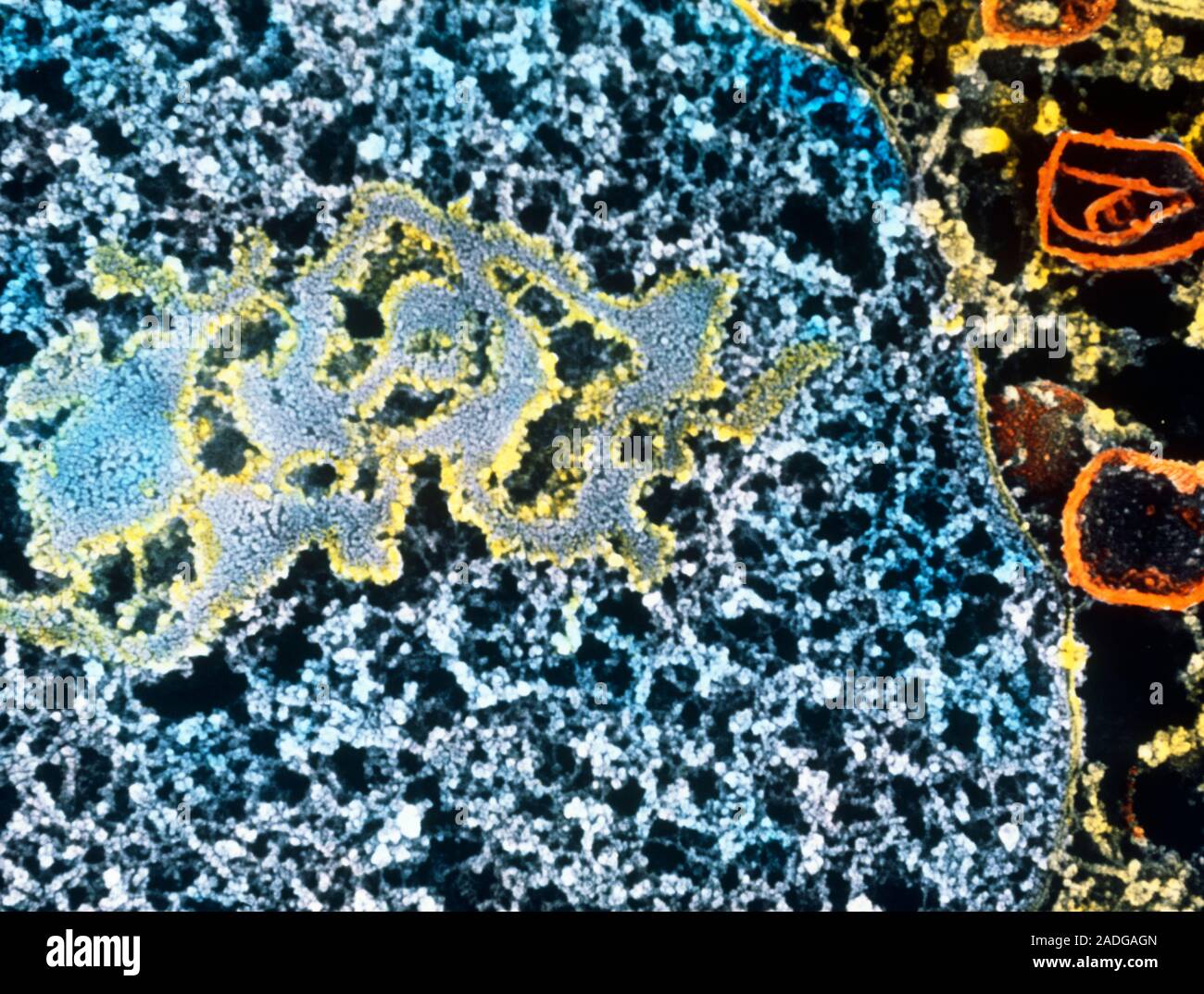 Nucleolus and chromatin fibres. Coloured high resolution scanning ...