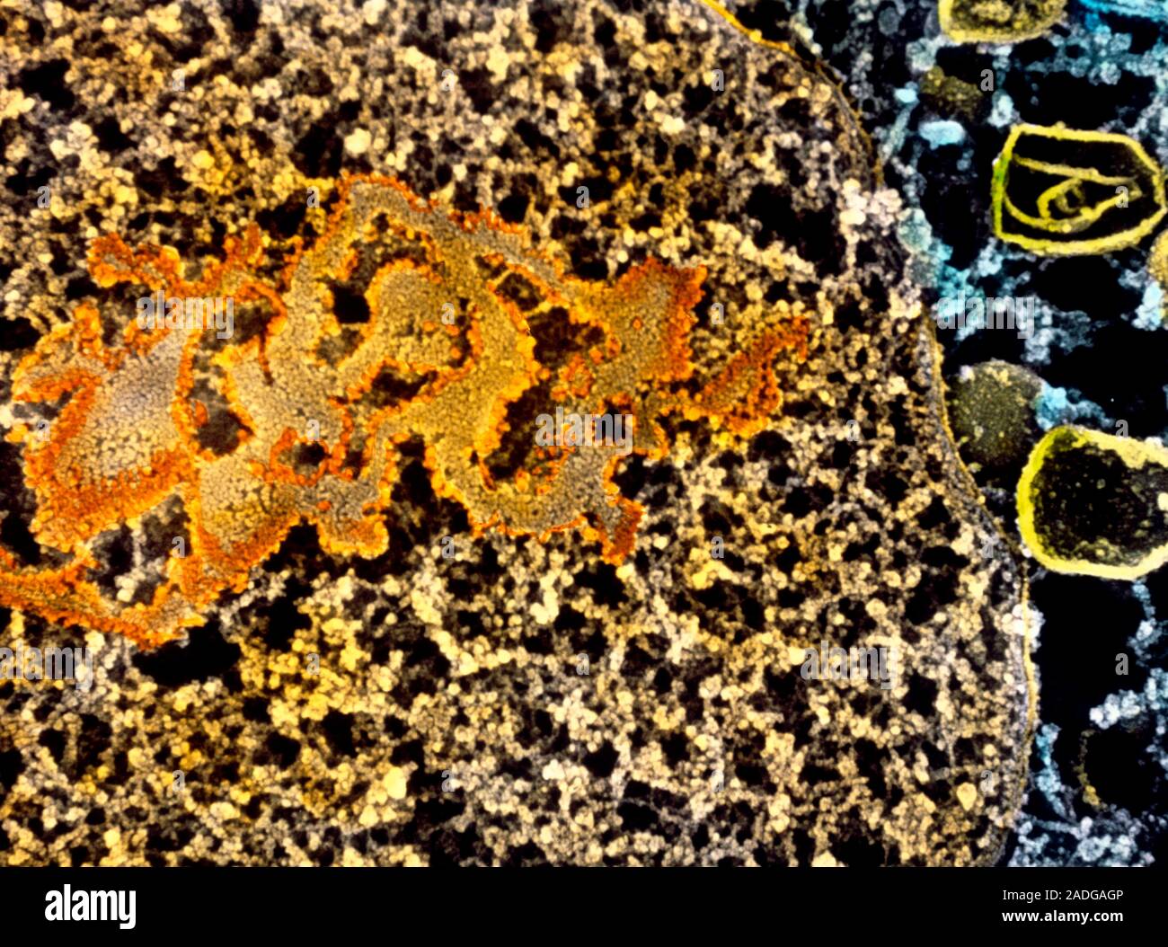 Nucleolus And Chromatin Fibres Coloured High Resolution Scanning