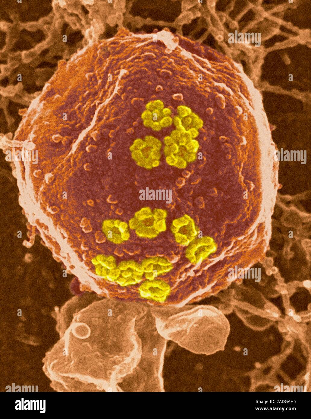 Yeast nucleus. Coloured scanning electron micrograph (SEM) of the ...