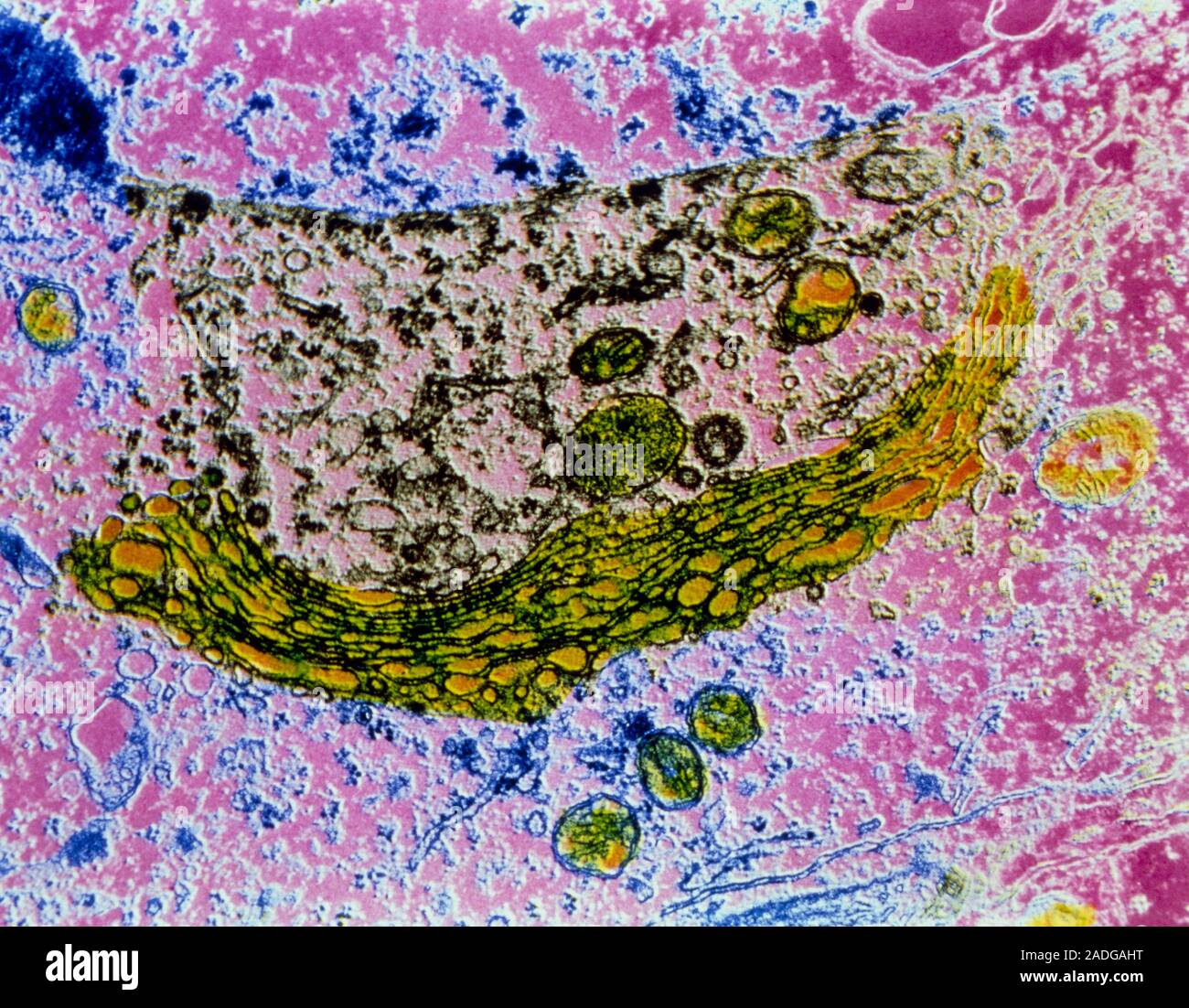 False-colour transmission electron micrograph of a Golgi apparatus ...