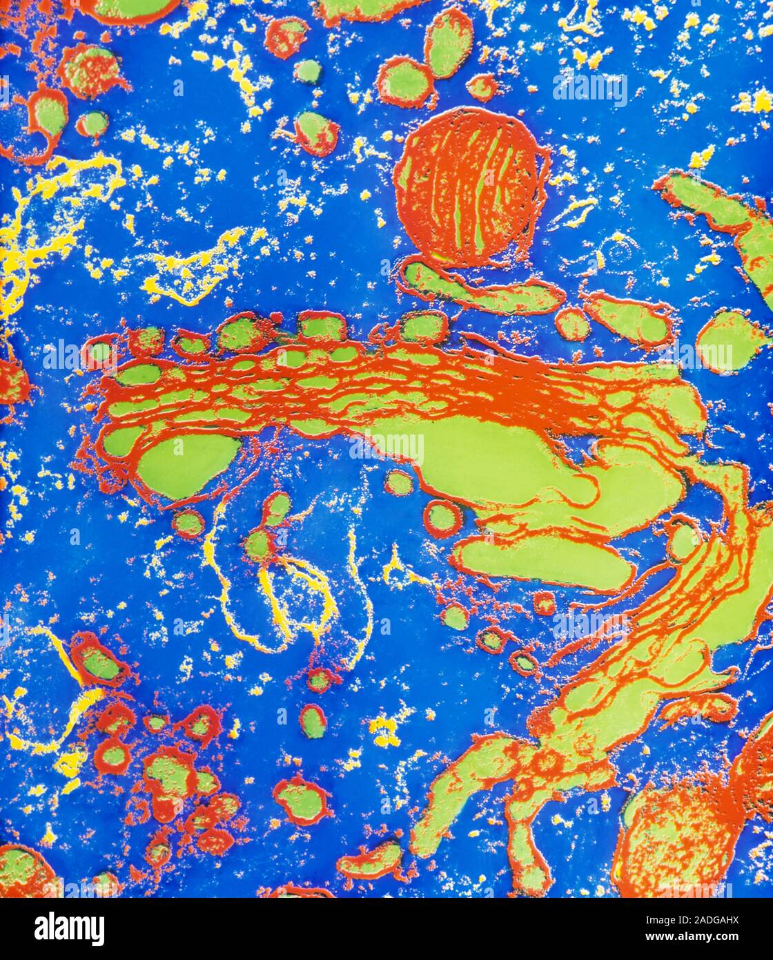 False-colour transmission electron micrograph of a section through a ...