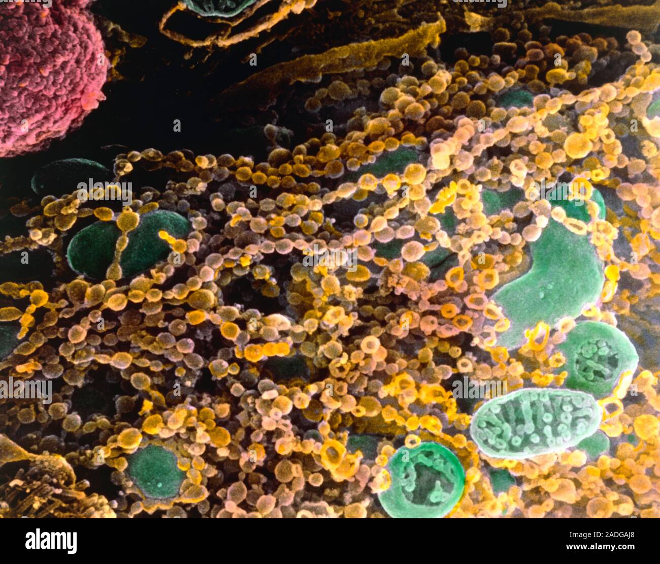 Vesicles in ovarian cell. Coloured Scanning Elec- tron Micrograph (SEM ...