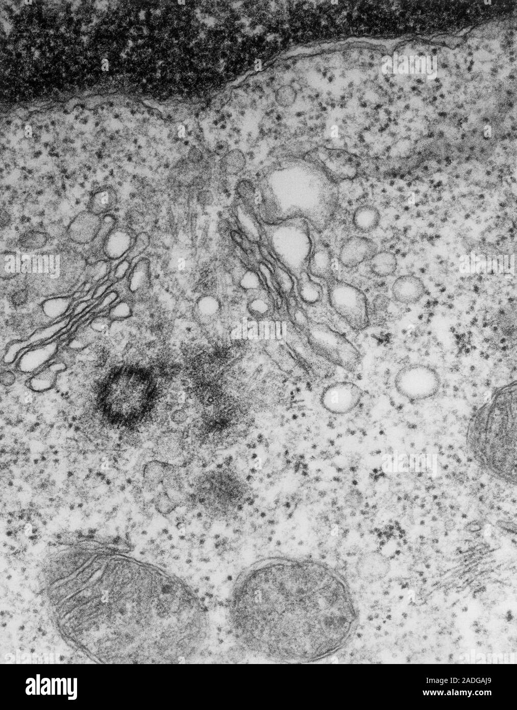 Golgi apparatus. Transmission electron micrograph of a Golgi apparatus ...