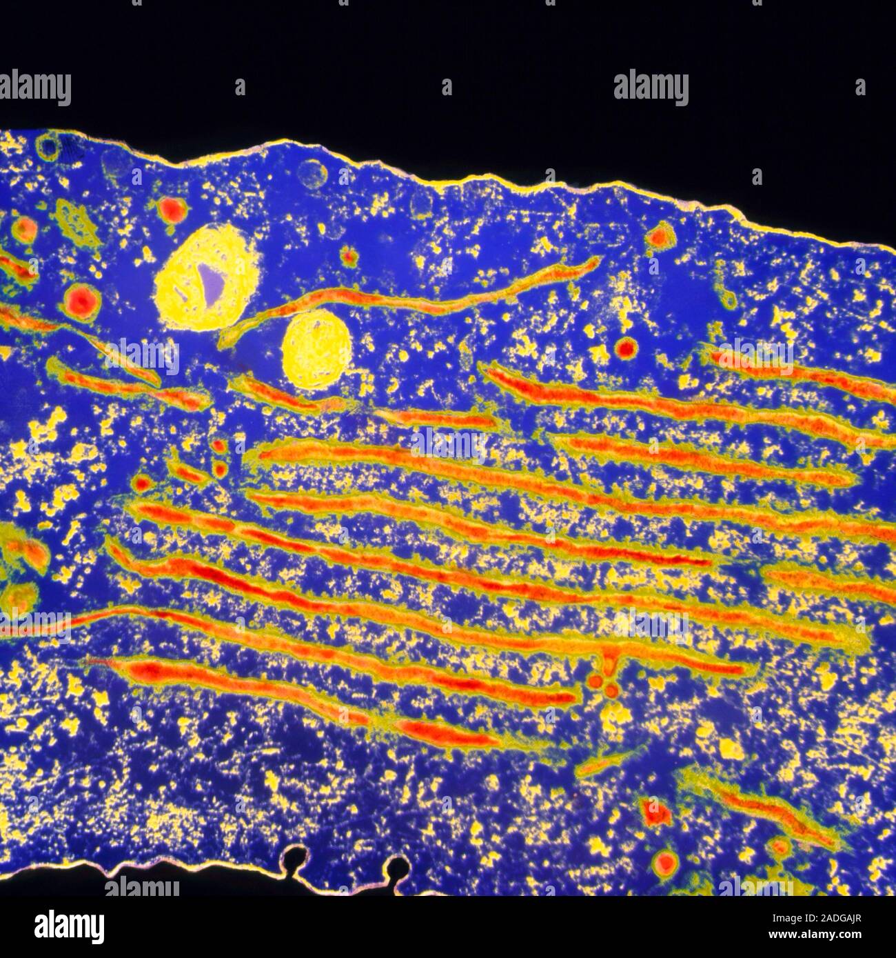 Rough endoplasmic reticulum. Transmission electron micrograph (TEM) of ...