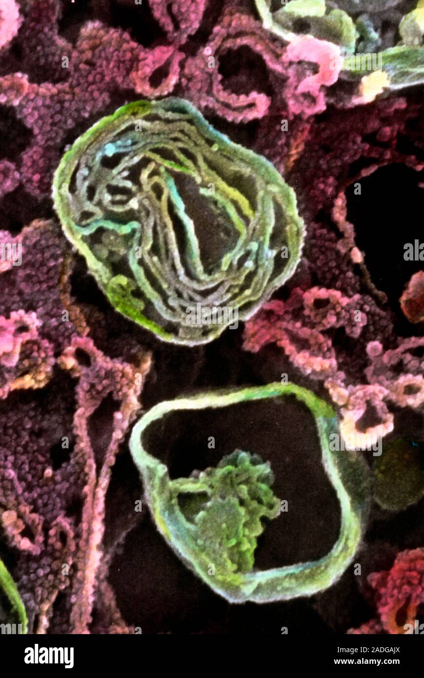 Lysosomes. Scanning electron micrograph (SEM) of two lysosomes in a ...