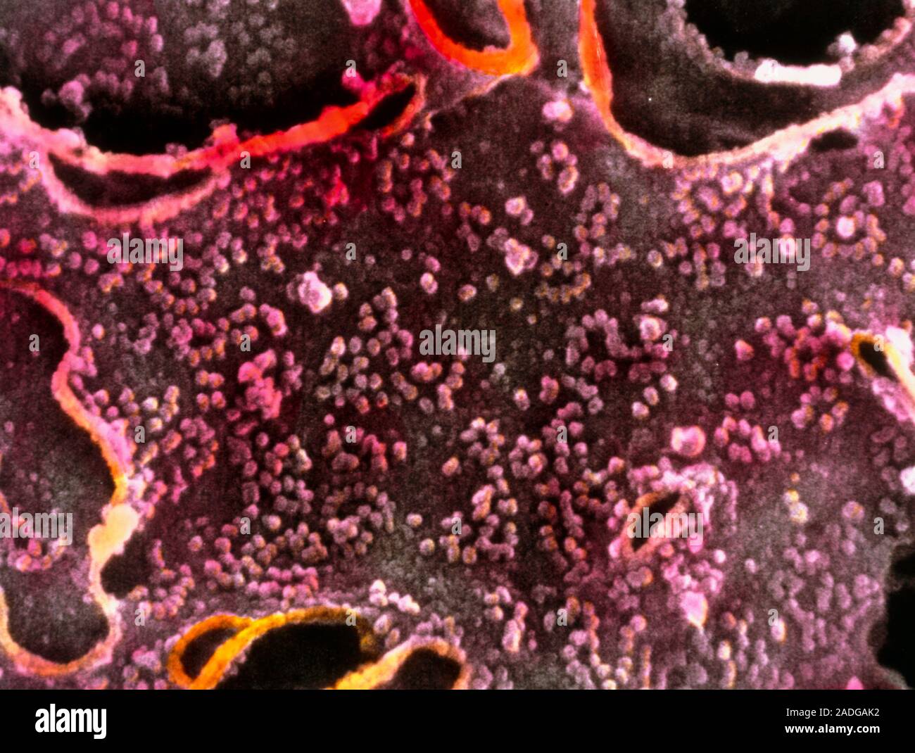 Rough endoplasmic reticulum. Coloured high resolution scanning electron ...
