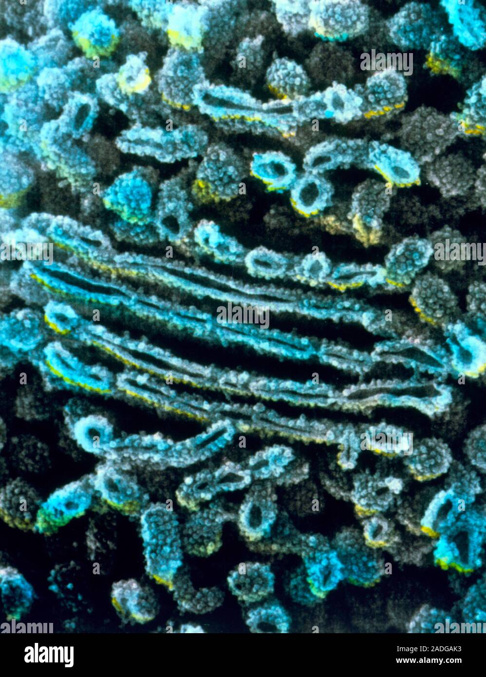 Rough endoplasmic reticulum. Coloured high resolution scanning electron ...