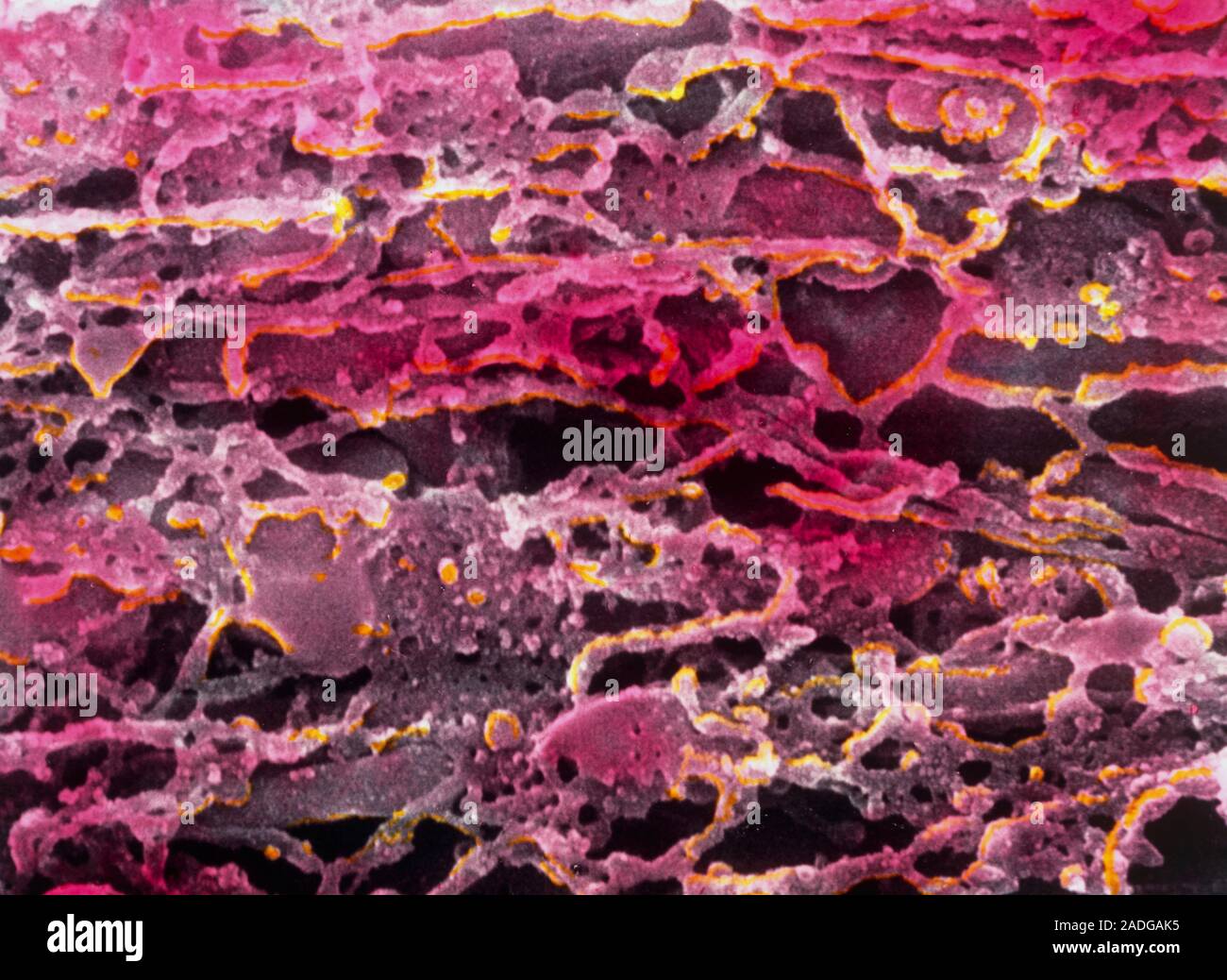 Endoplasmic reticulum. Coloured high resolution scanning electron ...