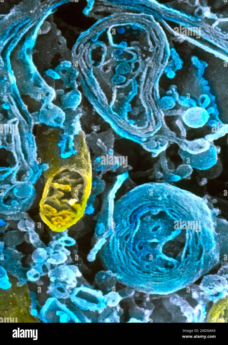 Lysosomes. Coloured high resolution scanning electron micrograph (SEM ...