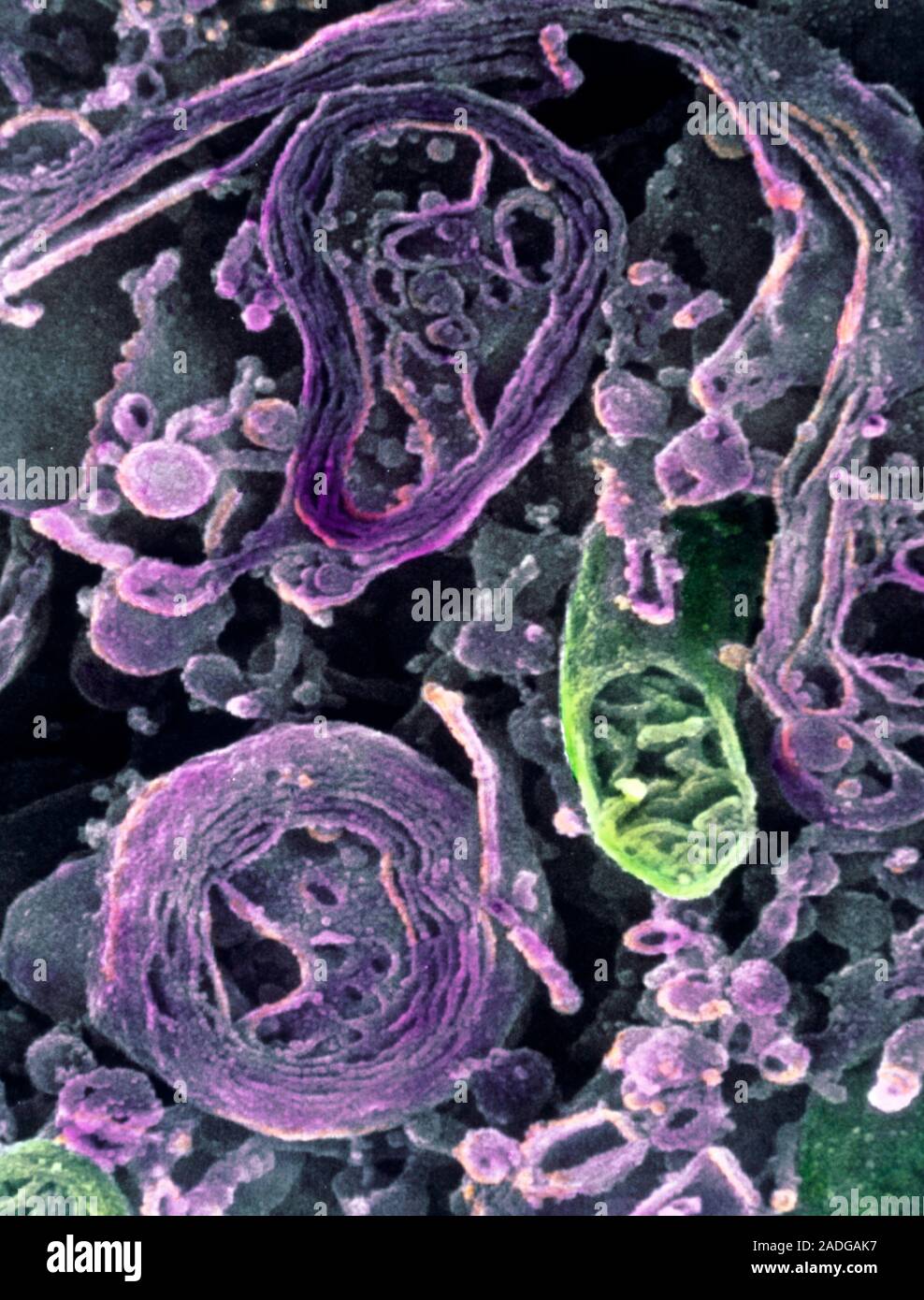 Lysosomes. Coloured high resolution scanning electron micrograph (SEM ...