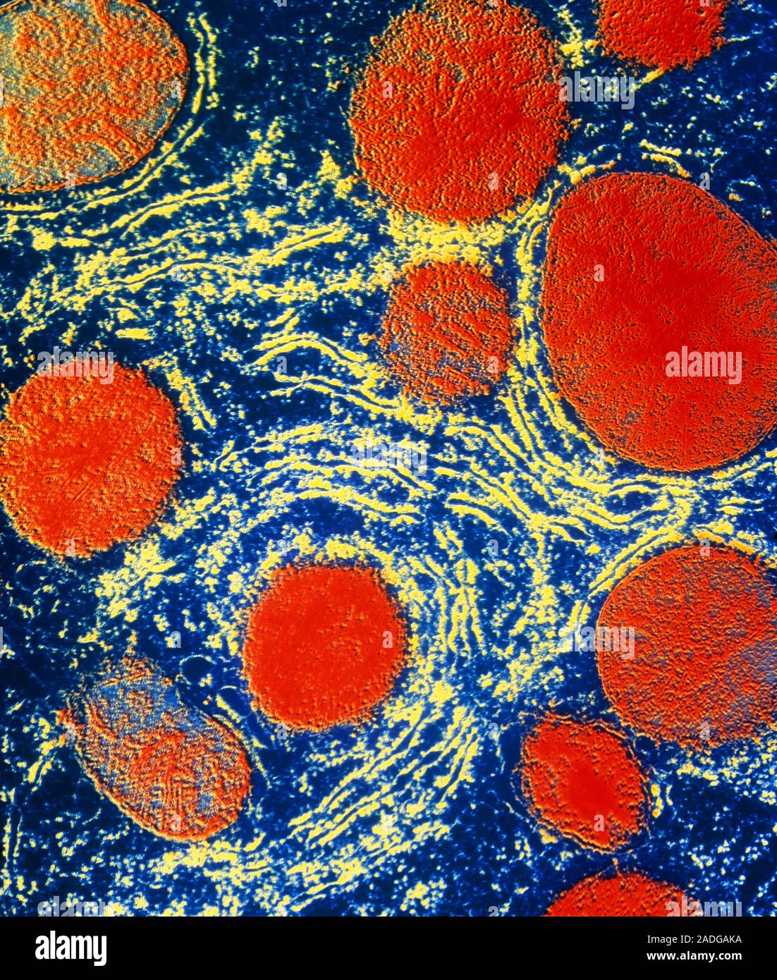 Rough endoplasmic reticulum and mitochondria. Coloured transmission ...