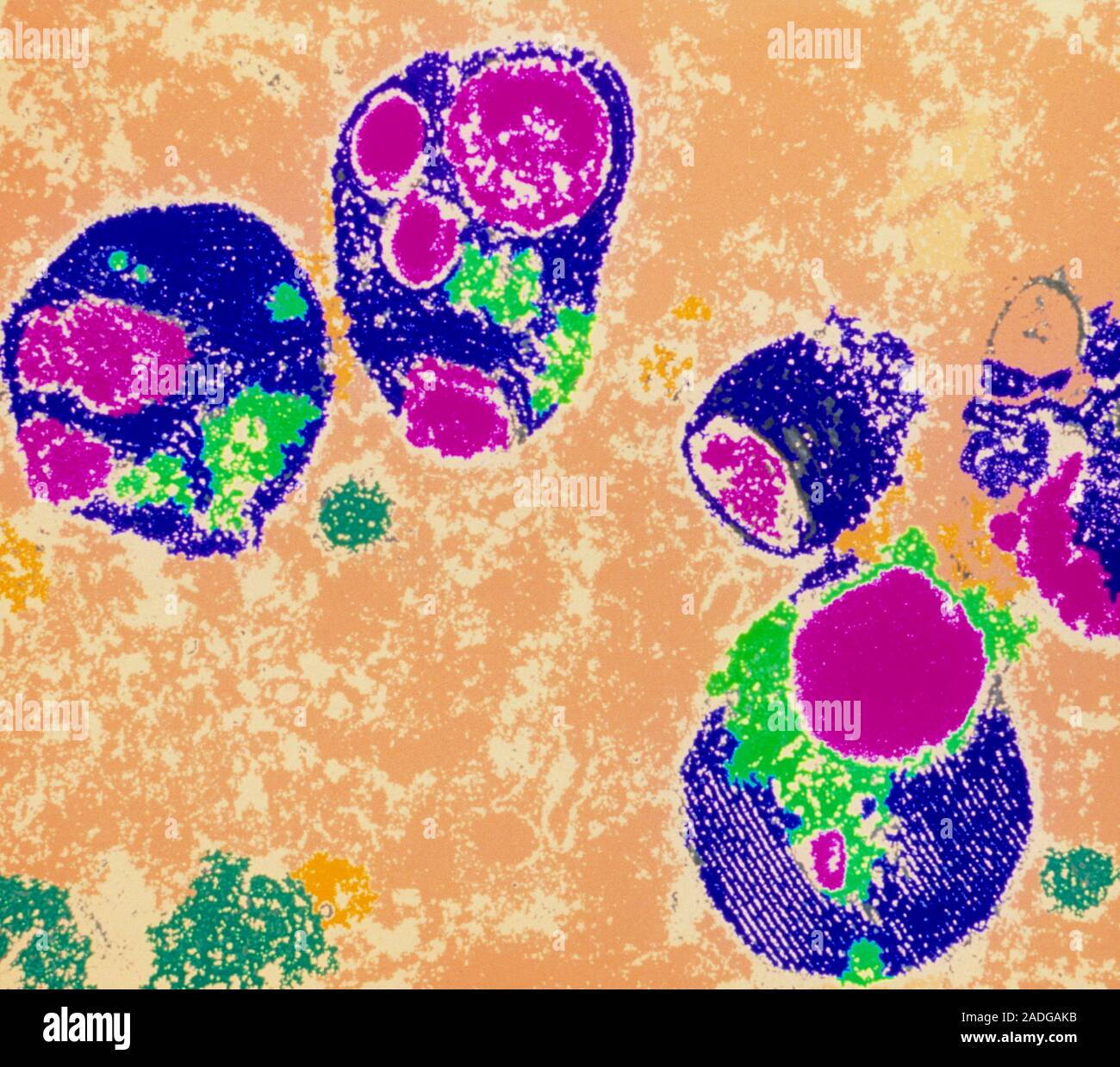 Lysosomes. Coloured transmission electron micrograph (TEM) of some ...