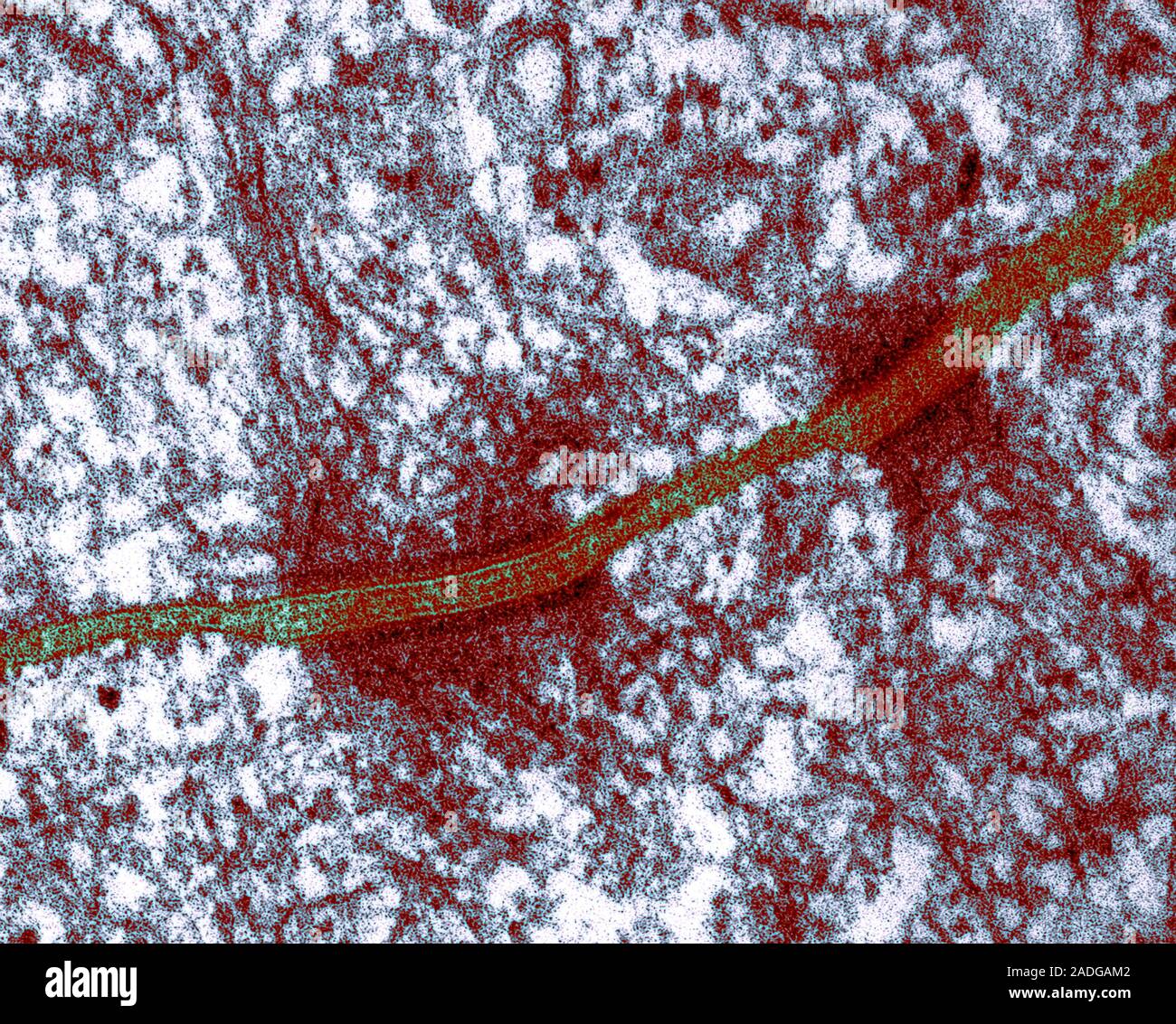Desmosomes. Coloured transmission electron micrograph (TEM) of a ...