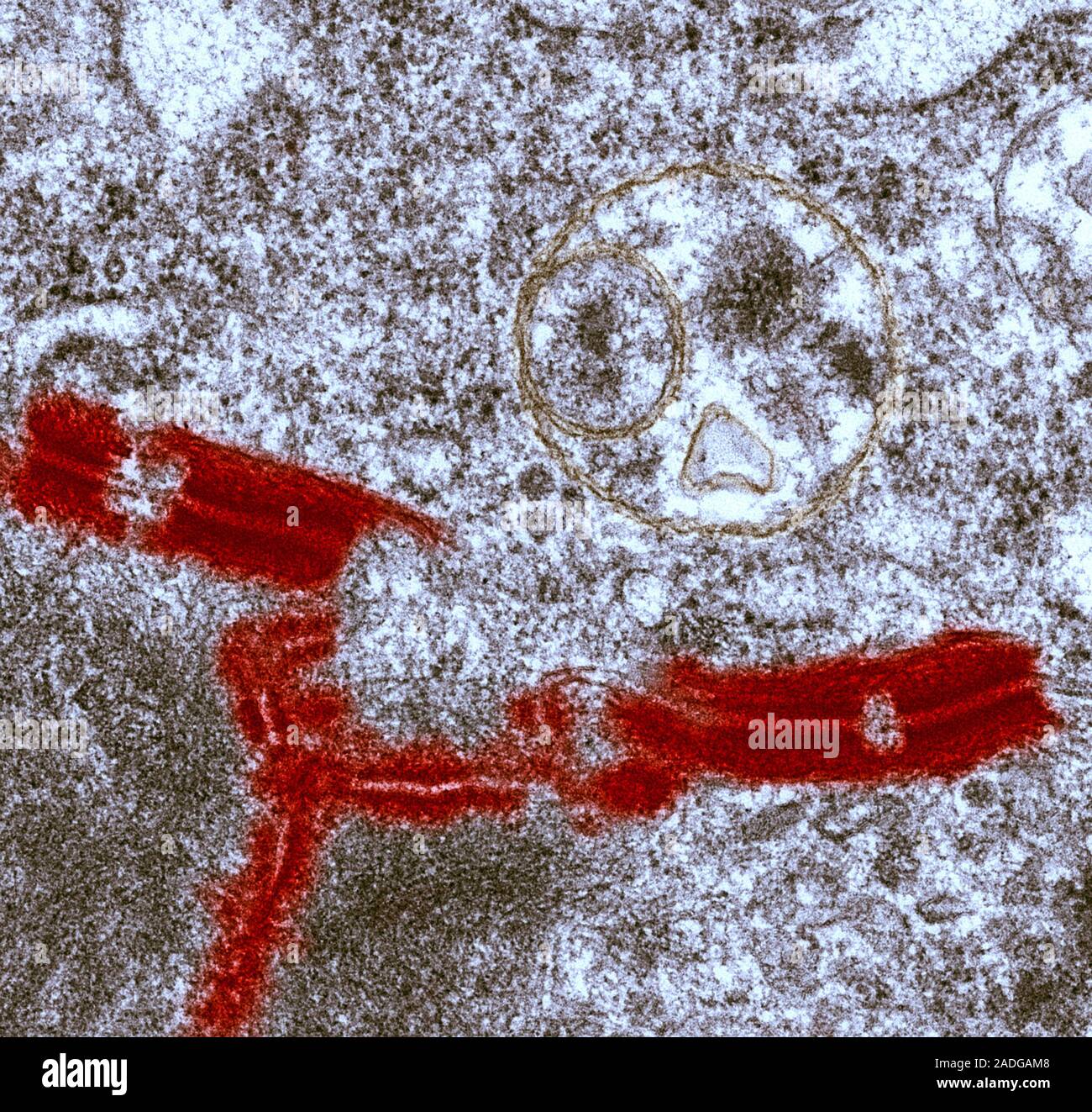 Desmosome cell junctions. Coloured transmission electron micrograph ...