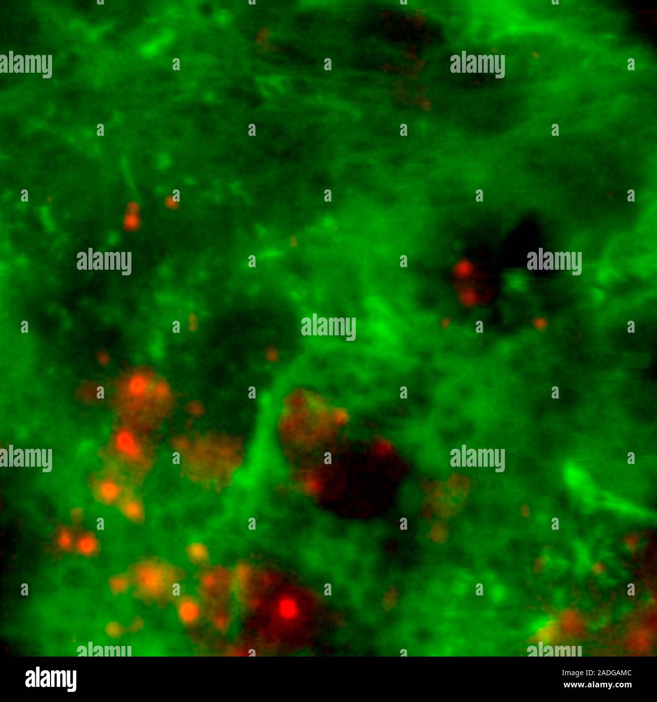 Pinocytosis. Coloured atomic force micrograph (AFM) overlayed with a ...