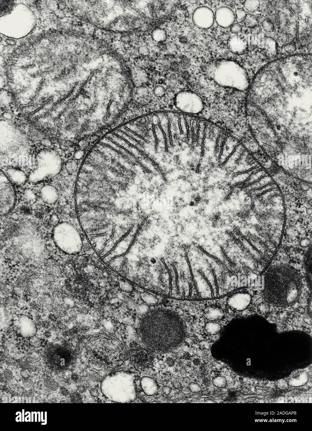 Mitochondria. Transmission electron micrograph of mitochondria from a ...