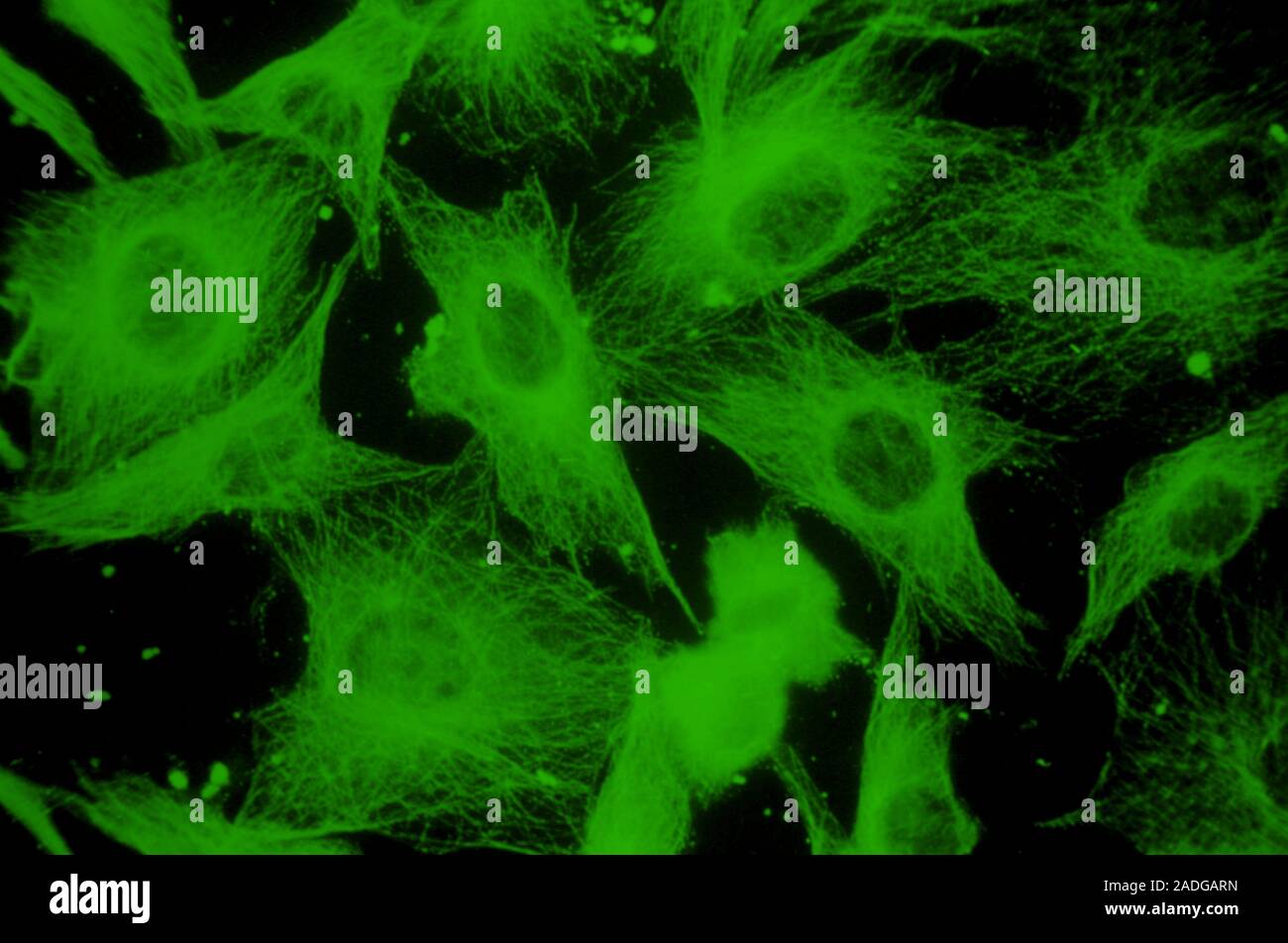 False-colour tubulin immunofluorescence micrograph of tissue culture ...