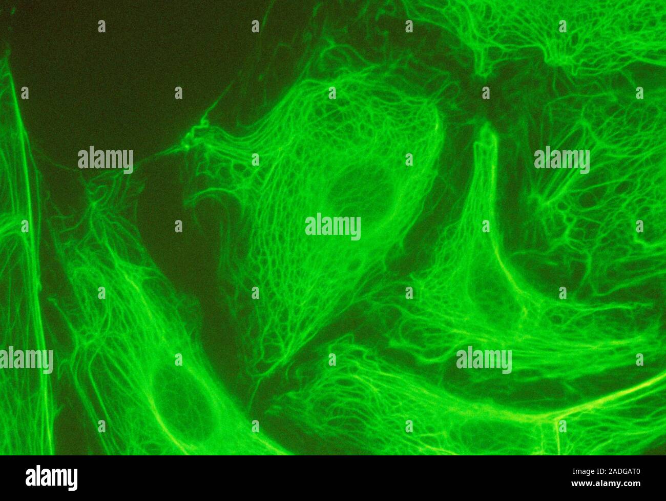Ultraviolet fluorescence light micrograph of cytoskeletons showing the ...