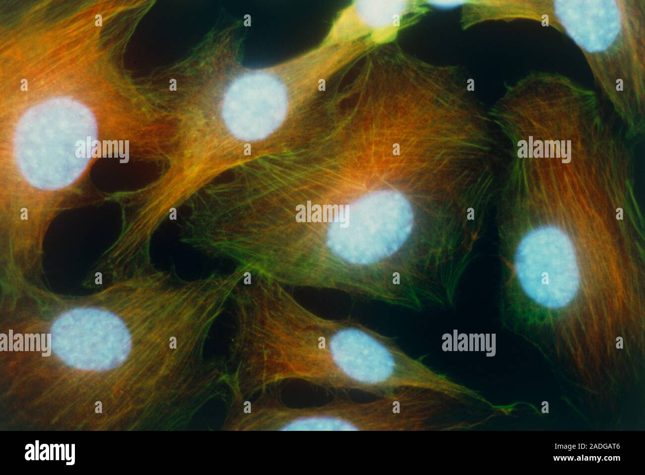 Cell cytoskeleton. Immunofluorescent light micrograph (LM) of cells ...