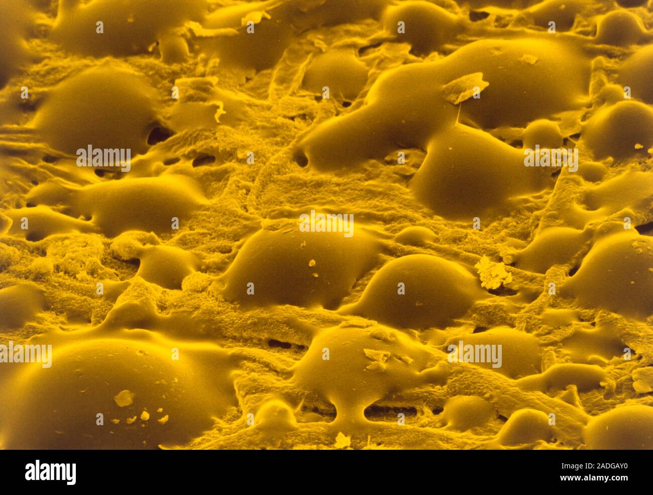 False-colour scanning electron micrograph (SEM) of the sticky surface ...