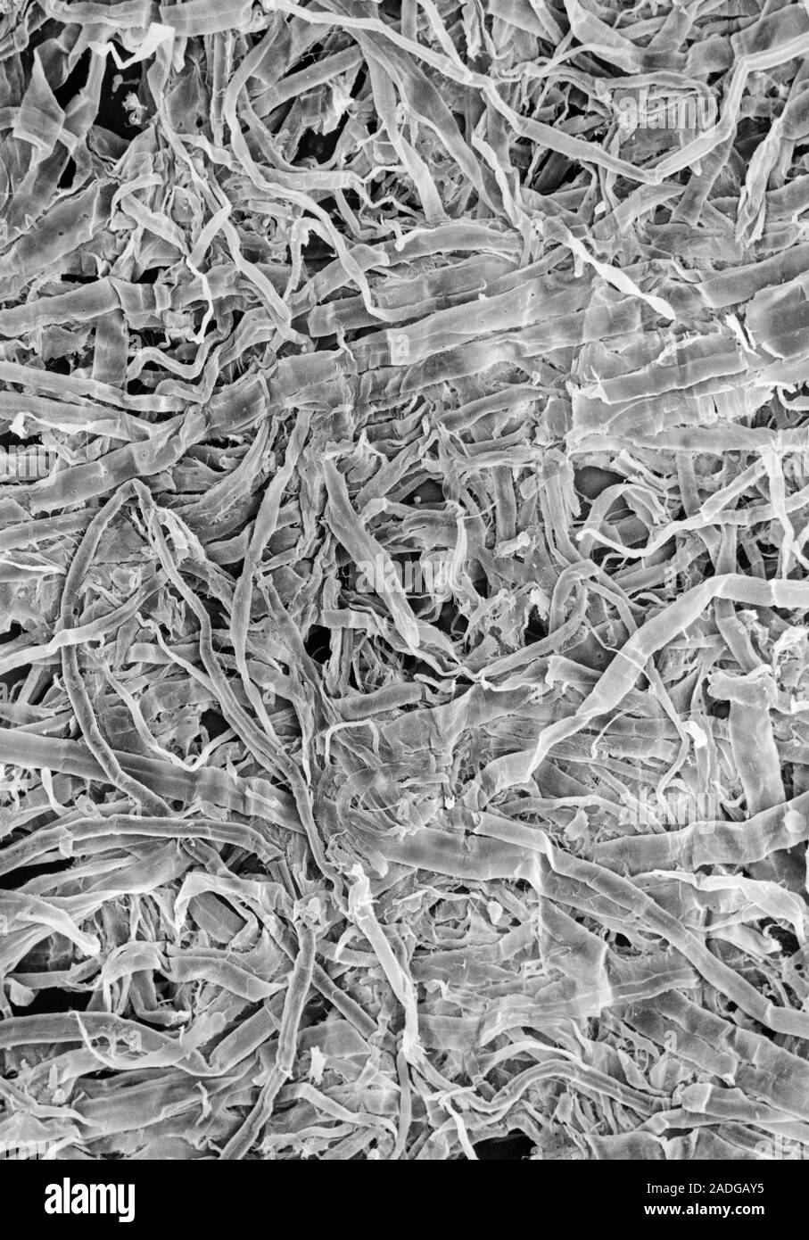 Scanning electron micrograph (SEM) of the surface of soft tissue paper ...