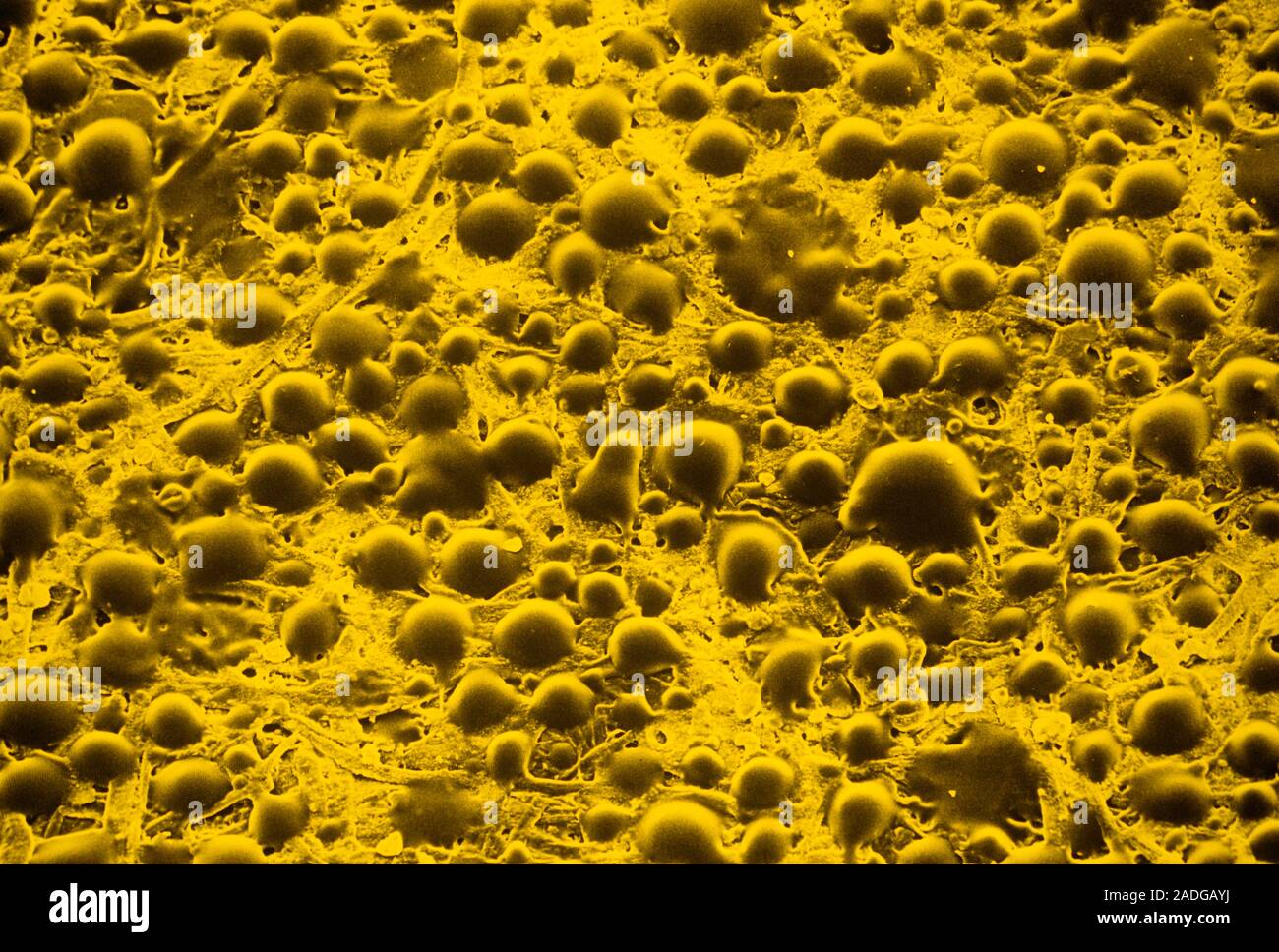 False-colour scanning electron micrograph (SEM) of the sticky surface ...