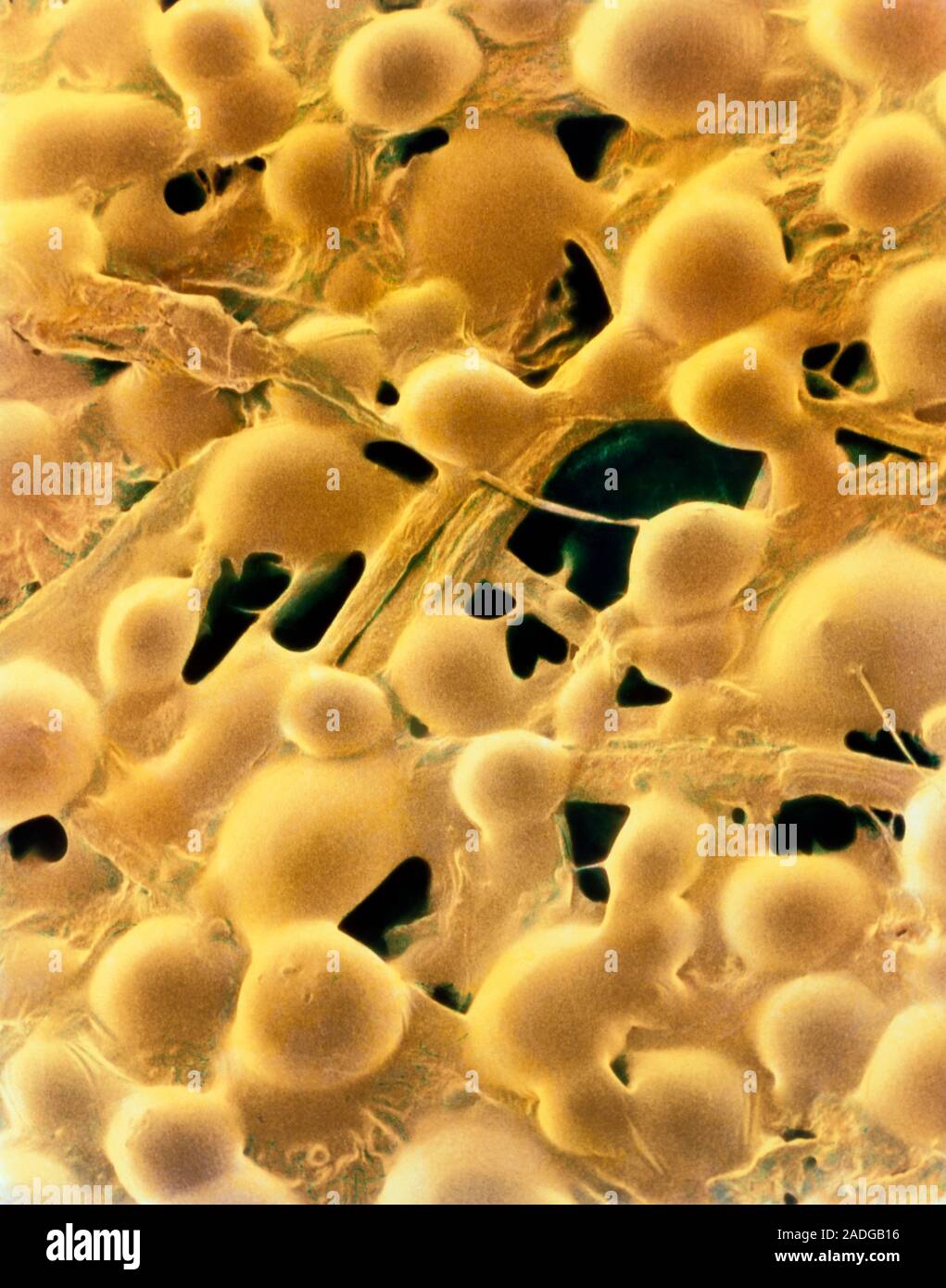 Post-It. Coloured scanning electron micrograph of the sticky surface of ...