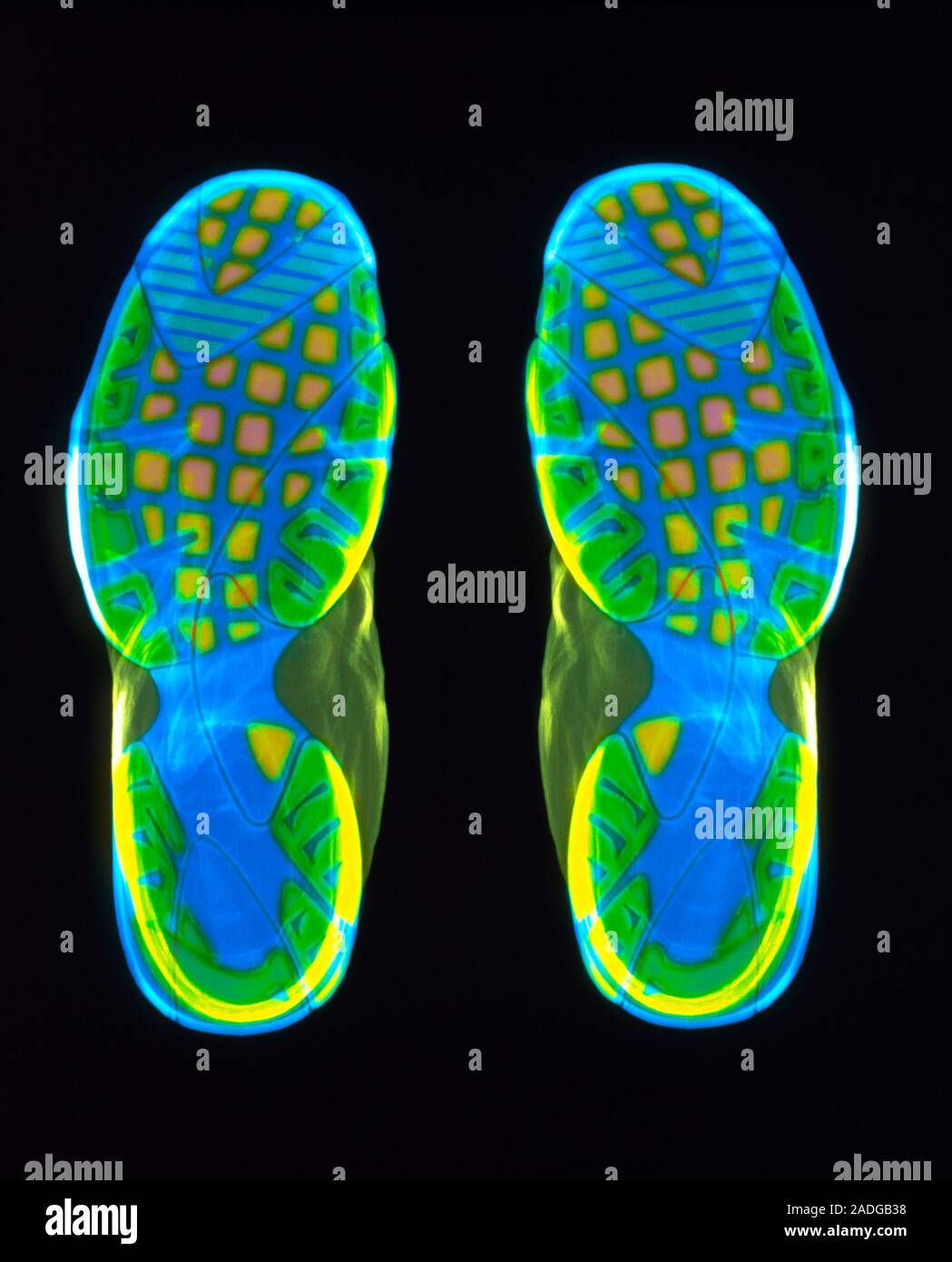 Trainer shoes. Coloured X-ray of the antiskidding soles of two trainer ...