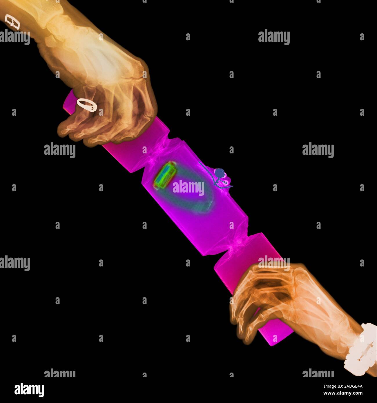 Party cracker. Coloured X-ray of hands pulling on a party or Christmas ...