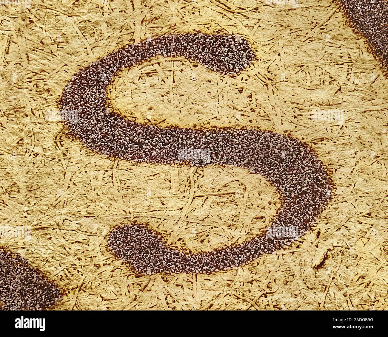 Photocopied letter. Coloured scanning electron micrograph (SEM) of a ...