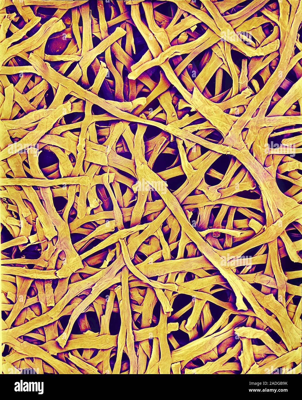 Seaweed paper fibres, coloured scanning electron micrograph (SEM). Many ...